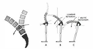 Lumbopelvic Rhythm & Lower Back Pain in Gymnasts