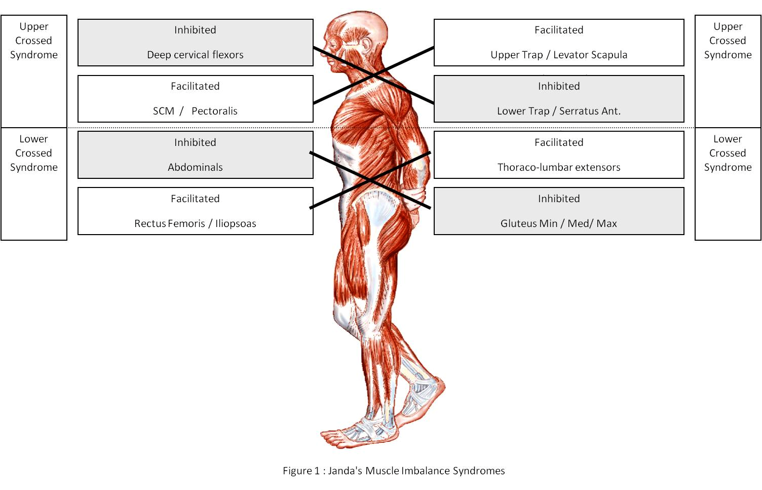 Janda Crossed Pattern Ergonomics - Capital Area PT & Wellness